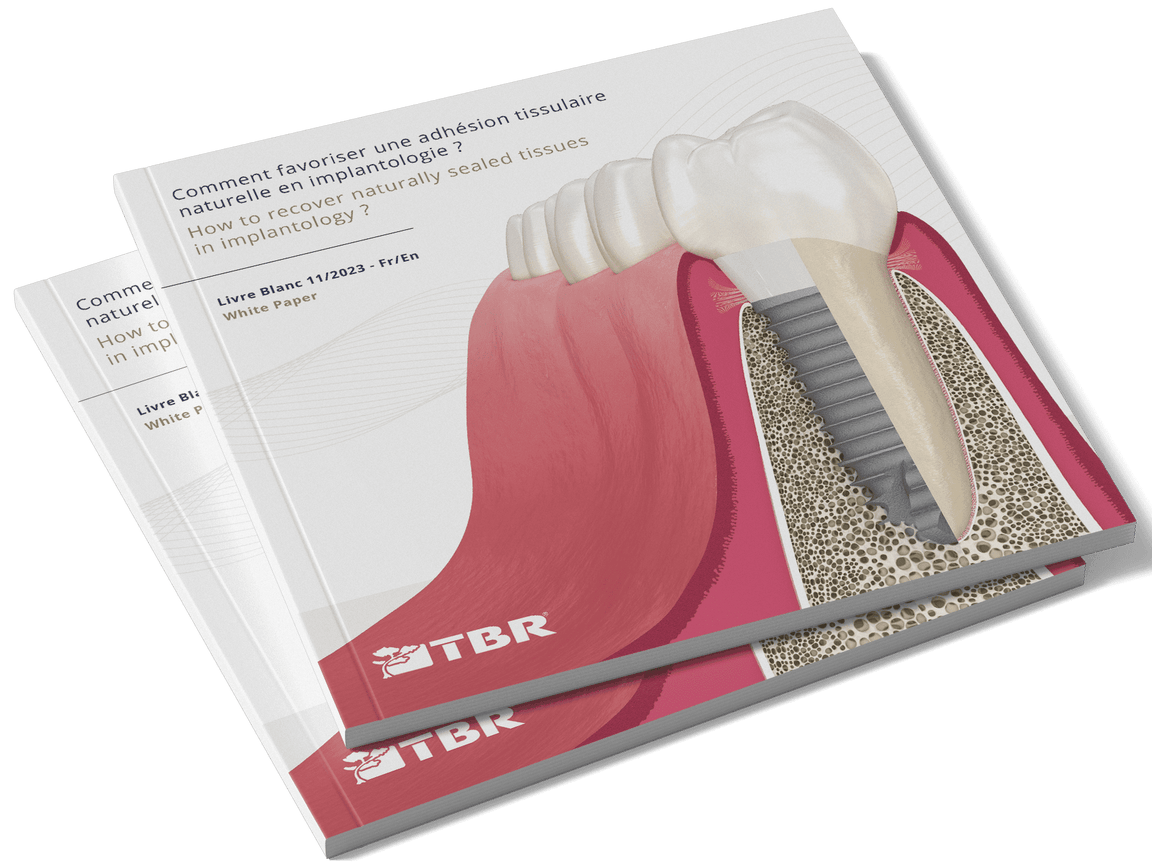 Catalogs - TBR Dental